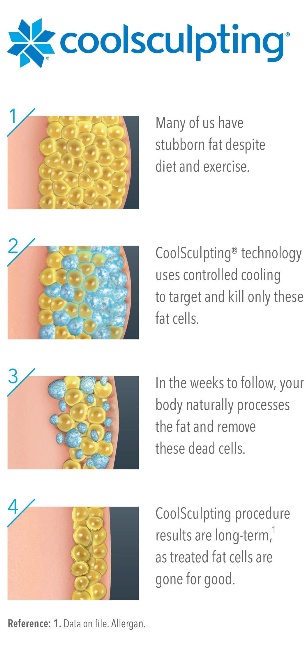 Coolsculpting Newburgh, NY | Hudson Valley | Dr. Rubinstein