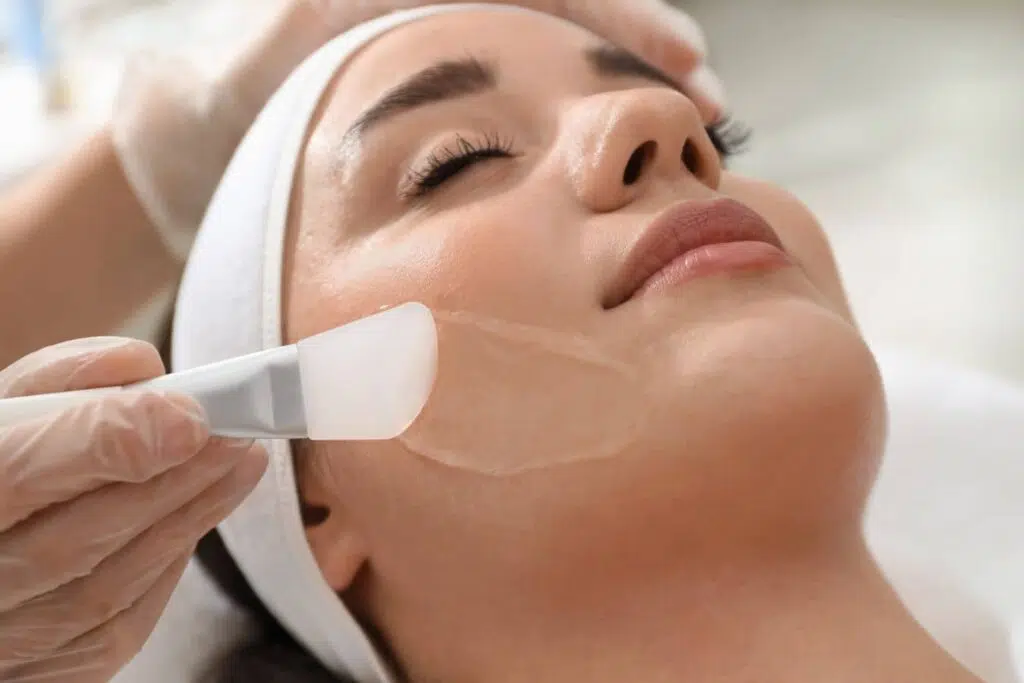 How to Choose the Right Chemical Peel | Newburgh, NY